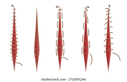 Different Surgical Stitches Isolated On White Stock Vector (Royalty ...