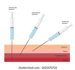 Differents Syringe Angles Injections Intramuscular Subcutaneous ...