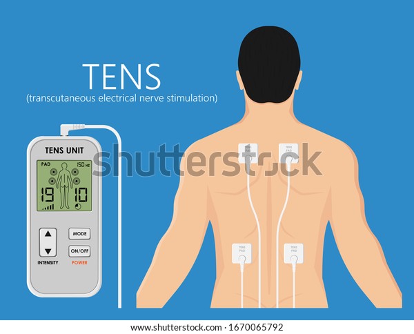 Digital Tens Transcutaneous Electrical Nerve Stimulation Stock Vector ...