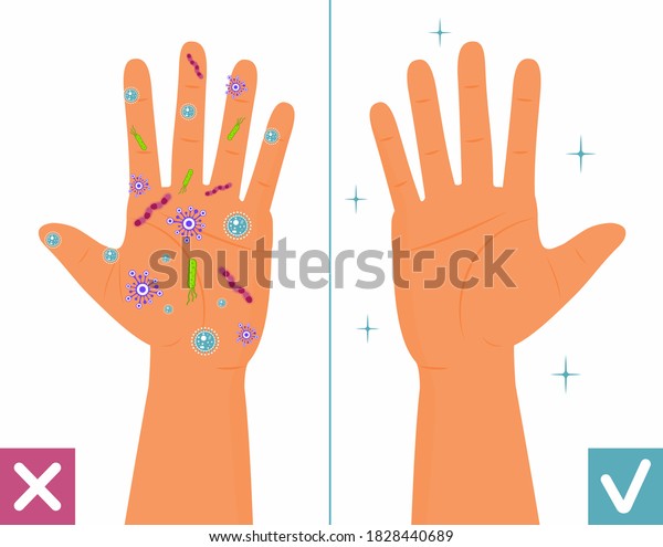 Dirty Clean Hands Hygiene Body Infection Stock Vector (Royalty Free ...