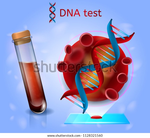 Dna Blood Test Realistic Vector Concept Stock Vector (Royalty Free ...