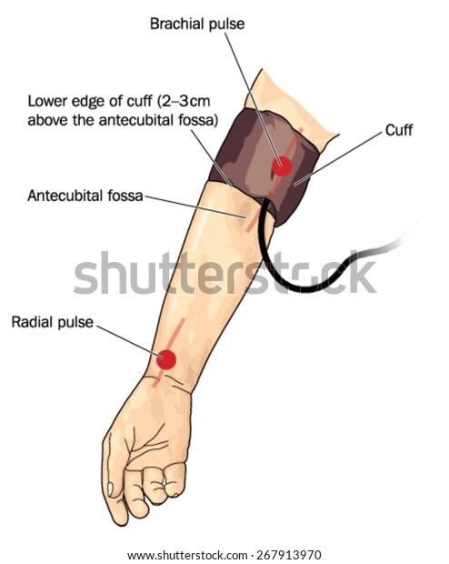 Drawing Blood Pressure Cuff On Arm Stock Vector (Royalty Free ...