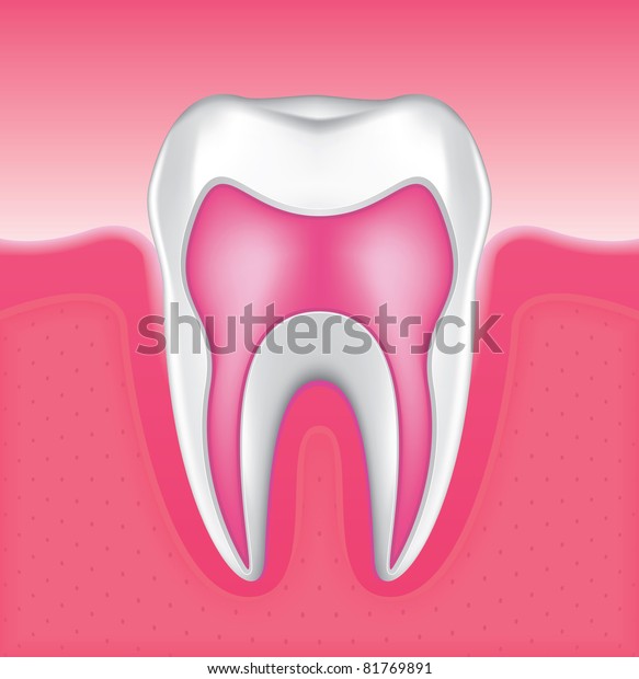 Drawing Gums Tooth Enamel Stock Vector (Royalty Free) 81769891 ...