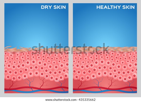 Dry Healthy Skin Texture Vector Stock Vector (Royalty Free) 435335662 ...