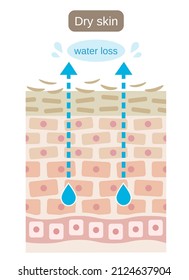 Dry Skin Cell Layer Illustration Moisture Stock Vector (Royalty Free ...