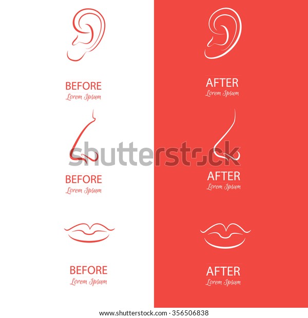 Ears Nose Lips Reshaping Before After Stock Vector (Royalty Free ...