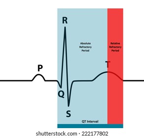 Ecg Absolute Relative Refractory Periods Color Stock Vector (Royalty ...