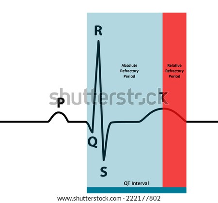 ECG Absolute Relative Refractory Periods Color Stock Vector (Royalty ...