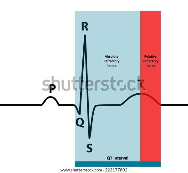 Ecg Absolute Relative Refractory Periods Color Stock Vector (Royalty ...
