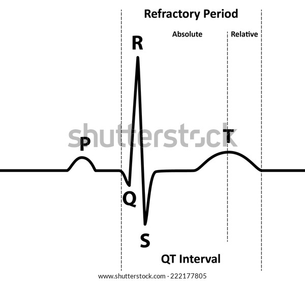 Ecg Absolute Relative Refractory Periods Black Stock Vector (Royalty ...