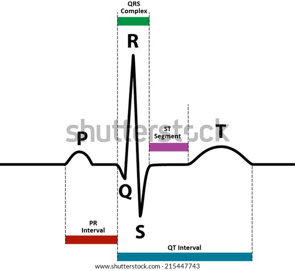 Ecg Ekg Normal Sinus Rhythm Wave 库存矢量图（免版税）215447743 | Shutterstock
