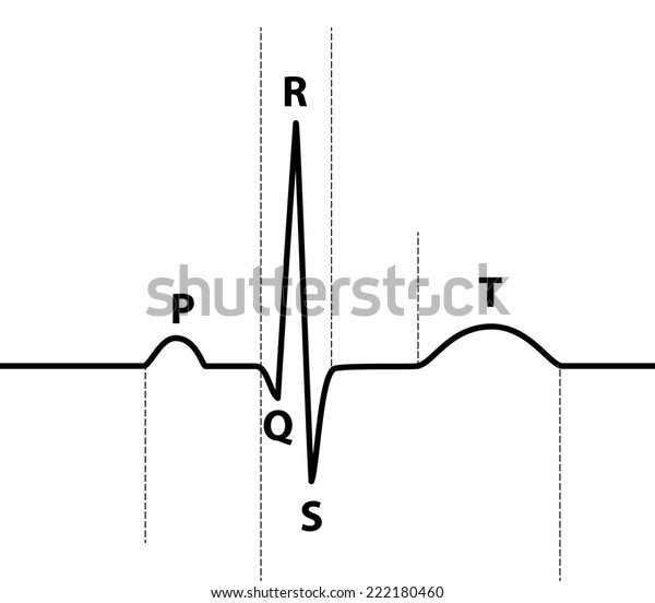 Ecg Waveform Labels Dotted Lines Stock Vector (Royalty Free) 222180460