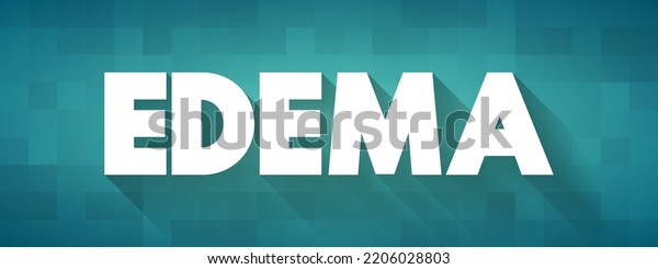 Edema Swelling Caused By Excess Fluid Stock Vector (Royalty Free ...