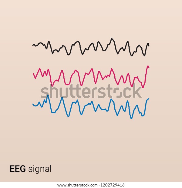 Eeg Signal Brain Electroencephalography: vector de stock (libre de ...