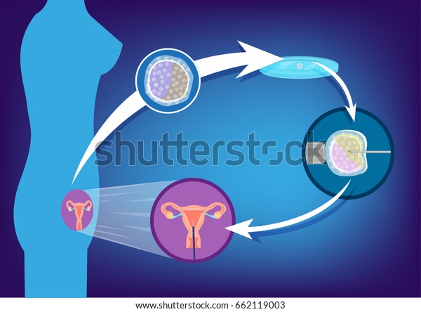 Egg Extraction Cycle Woman Be Used Stock Vector (Royalty Free ...