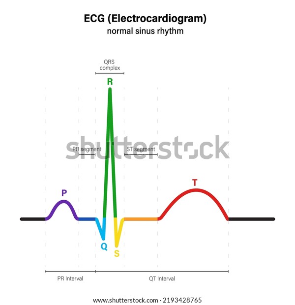 Electrocardiogram Ecg Ekg Normal Sinus Rhythm 库存矢量图（免版税）2193428765 ...
