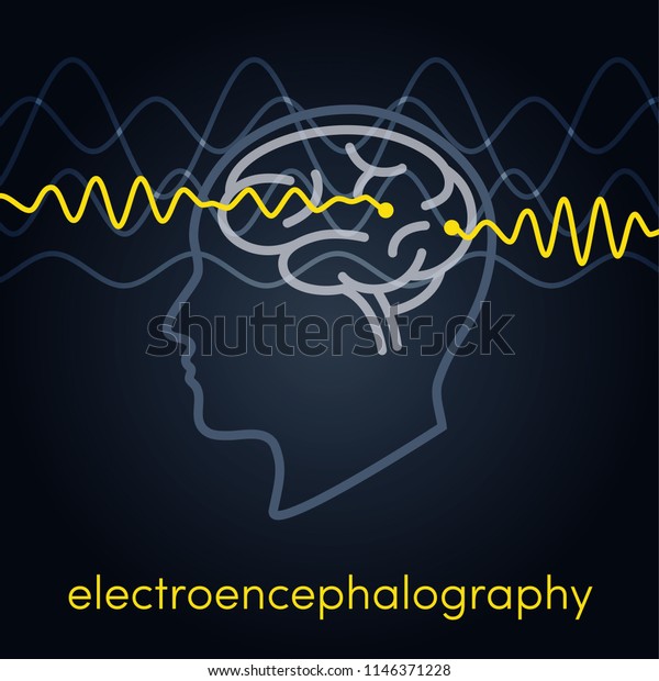 Electroencephalography Vector Concept Brain Wave Measurement Stock ...
