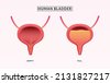 Bladder Control: Over 1,064 Royalty-Free Licensable Stock Photos ...