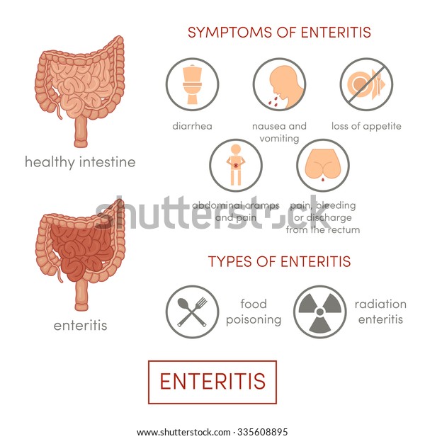 Enteritis. Symptoms of enteritis. Cartoon vector illustration for ...