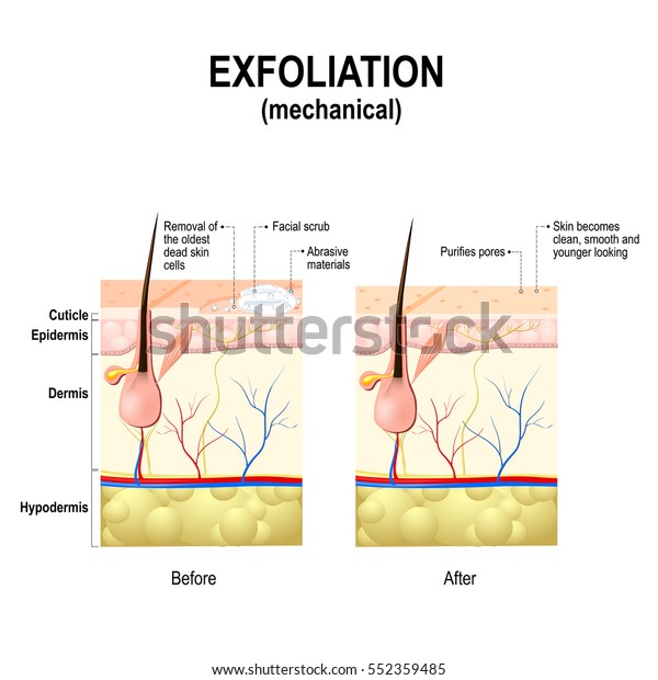 Exfoliation Peeling Cosmetic Procedure Physically Scrubbing Stock ...