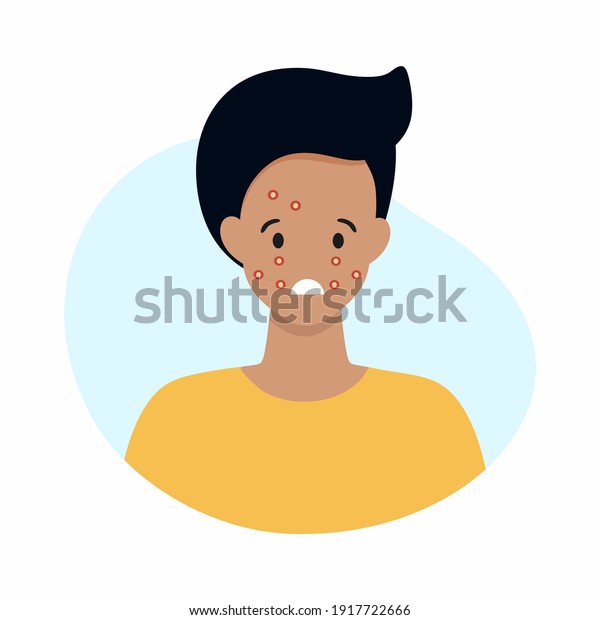 Face Man Acne On His Face Stock Vector (Royalty Free) 1917722666 ...