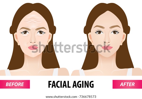 Facial Aging Before After Vector Illustration Stock Vector (Royalty ...
