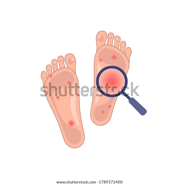 Feet Problem Skin Icon Representation Feet Stock Vector (Royalty Free ...