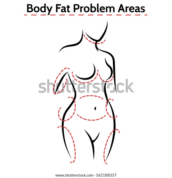 Female Body Fat Problems Areas Vector Stok Vektör (Telifsiz) 562188337 Female Body Fat Problems Areas Vector Stok Vektör (Telifsiz) 562188337