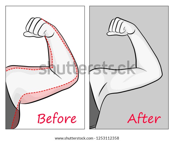 Female Hand Before After Playing Sports Stock Vector (Royalty Free ...