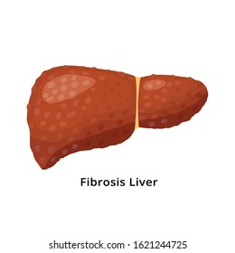 116 Enlarged liver vector Images, Stock Photos & Vectors | Shutterstock