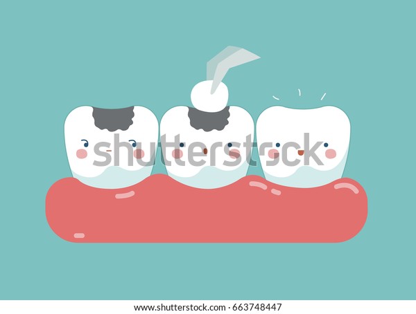Filling Tooth Teeth Tooth Concept Dental Stock Vector (Royalty Free ...