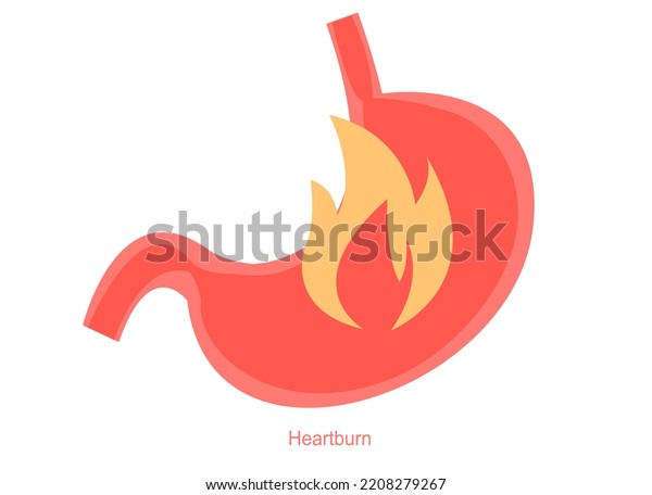 Fire Stomach Excessive Acidity Gastritis Gastric: เวกเตอร์สต็อก (ปลอด ...
