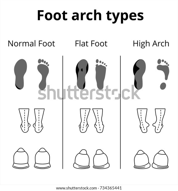 Foot Arch Types Vector Icons Set Stock Vector (Royalty Free) 734365441