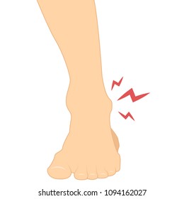 Leg Pain Cartoon Vector Leg Vector: เวกเตอร์สต็อก (ปลอดค่าลิขสิทธิ์ ...