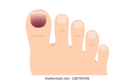 Foot Cartoon Vector Toe Vector Wallpaper Stock Vector (Royalty Free ...
