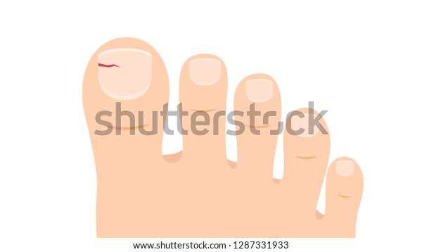 Foot Cartoon Vector Toe Vector Wallpaper Stock Vector (Royalty Free ...