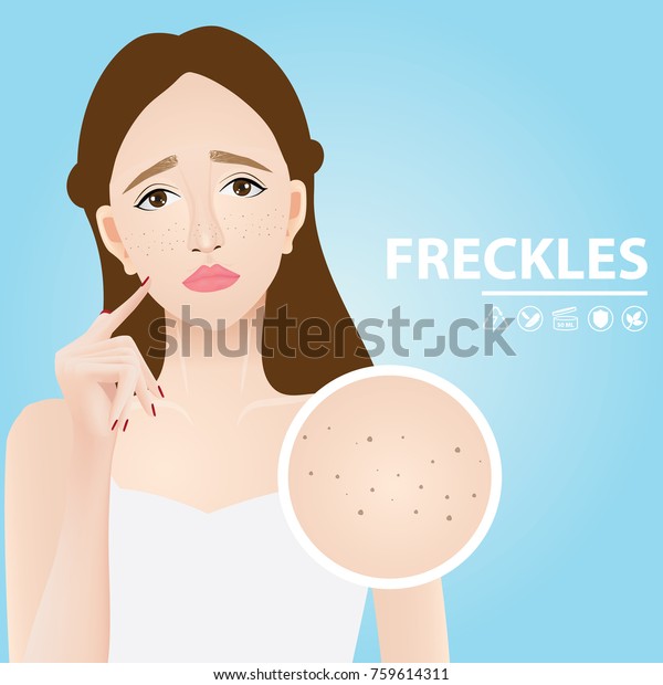 Freckles Skin Vector Illustration Stock Vector (Royalty Free) 759614311 ...