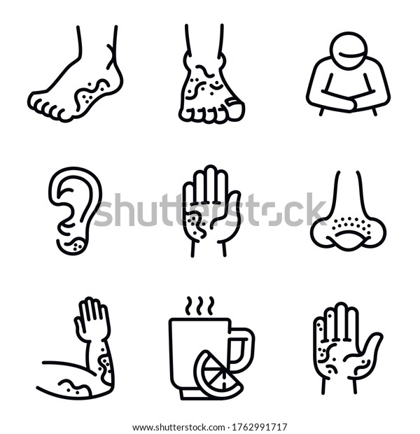 Frostbite Icons Set Outline Set Frostbite Stock Vector (Royalty Free ...