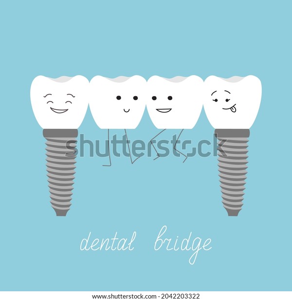 Funny Dental Bridge On Implants Stock Vector (Royalty Free) 2042203322 ...