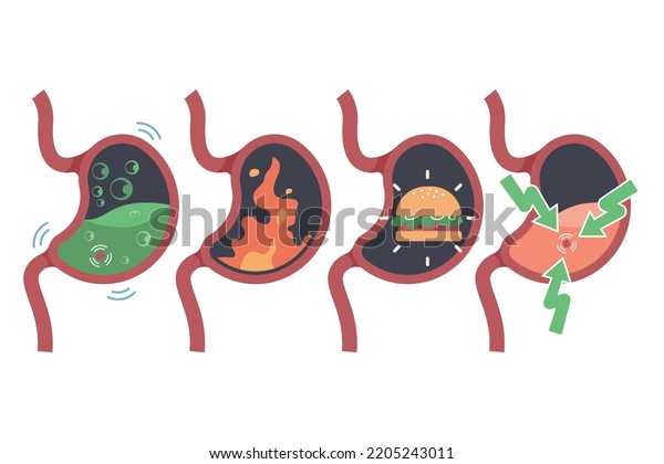 Gastric Bloating Vector Cartoon Set Isolated Stock Vector (Royalty Free ...