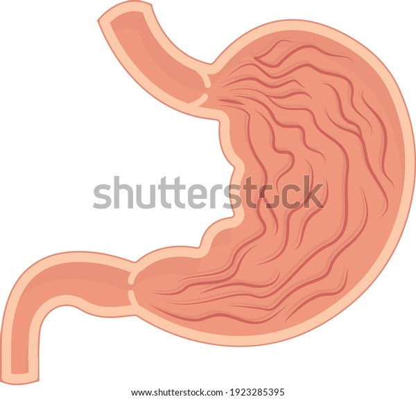 Gastritis Stomach Cross Section Inflammation Stock Vector (Royalty Free ...