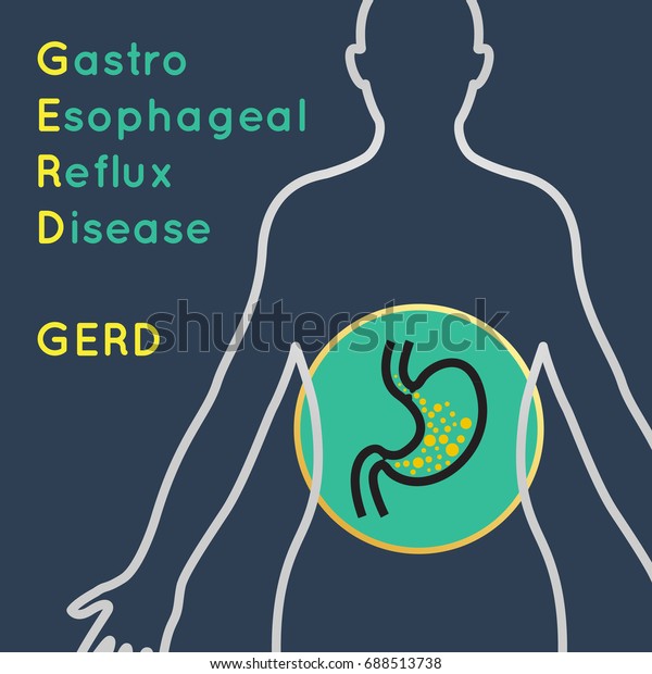 Gastroesophageal Reflux Disease (GERD) vector collection