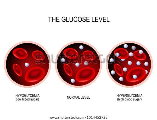 Glucose Blood Vessel Normal Level Hyperglycemia Stock Vector (Royalty ...