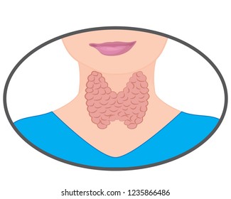 Goiter Images, Stock Photos & Vectors | Shutterstock