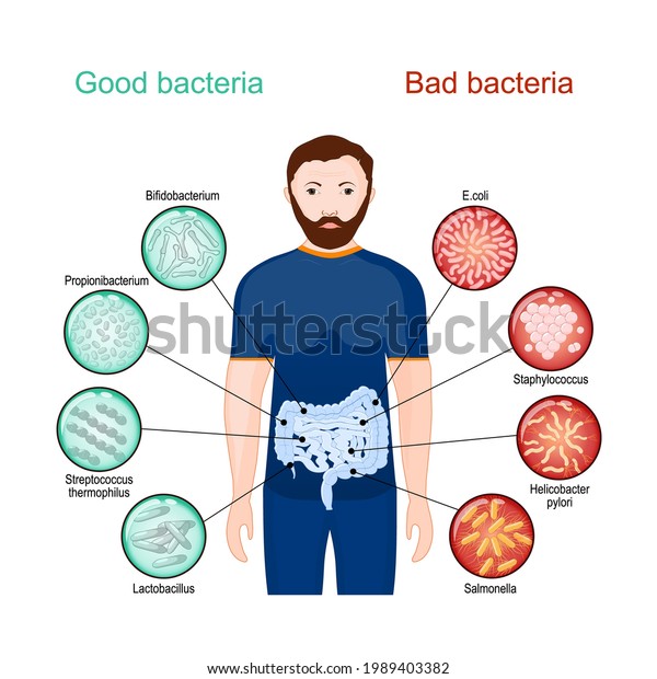Bacterias buenas y malas. Afiche sobre los probióticos y la salud de ...
