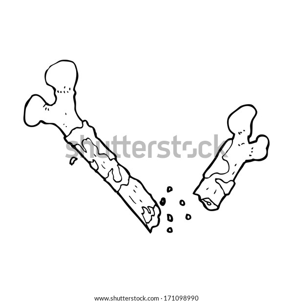 Gross Broken Bone Cartoon Stock Vector (Royalty Free) 171098990 ...