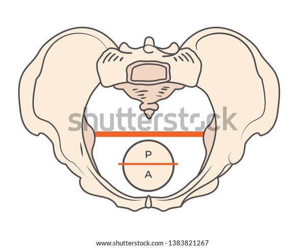 Gynecoid Pelvis Shape W Round Circular 스톡 벡터(로열티 프리) 1383821267