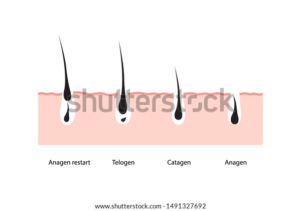 Hair Growth Cycle Skin Vector Illustration Stock Vector (Royalty Free ...