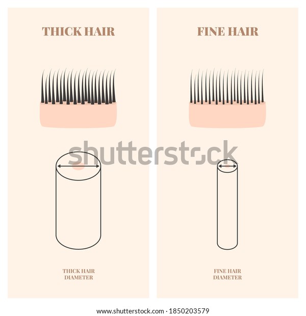 Hair Thickness Types Classification Set Skin Stock Vector (Royalty Free ...