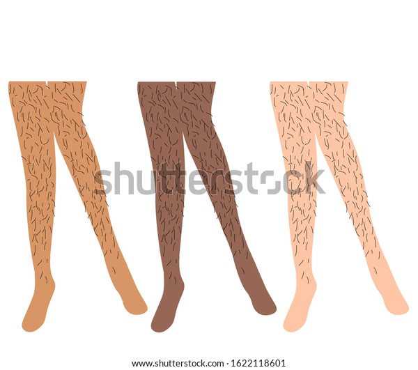 Hairy Legs Vector Image Female Body 스톡 벡터(로열티 프리) 1622118601 | Shutterstock